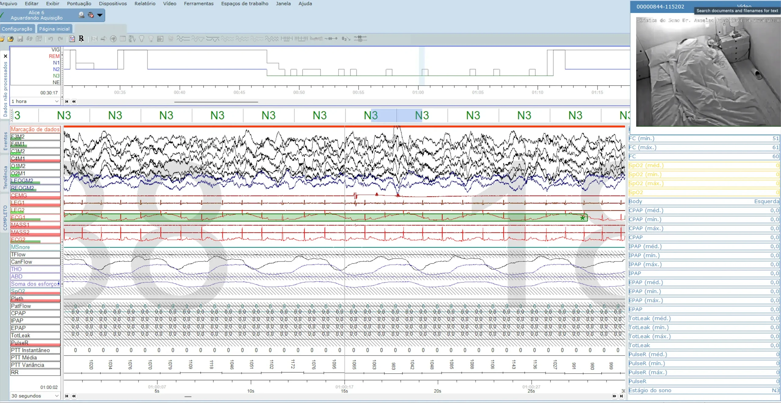 O que é uma Polissonografia (PSG)? | Clínica Do Sono